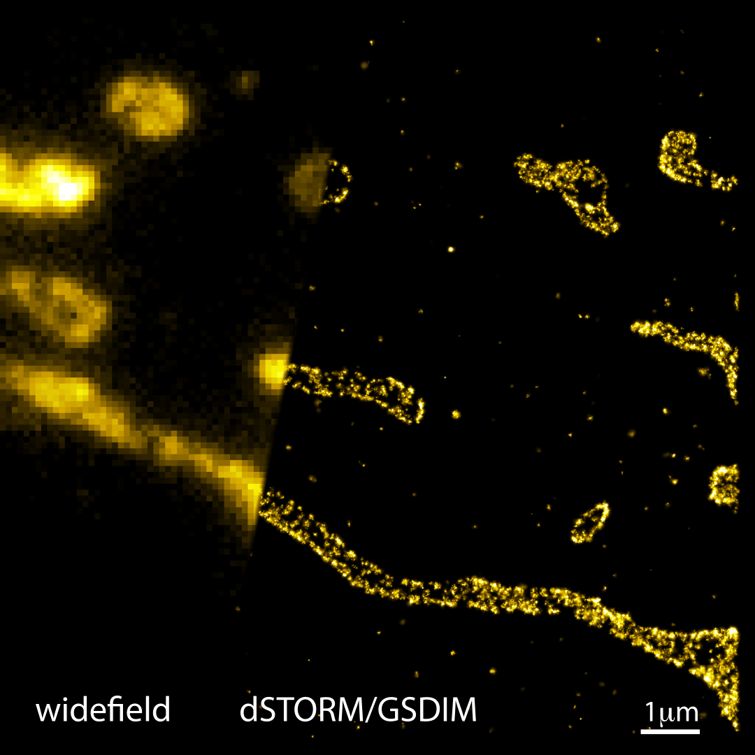 Integrated Microscopy Technologies (IMT) - SciLifeLab