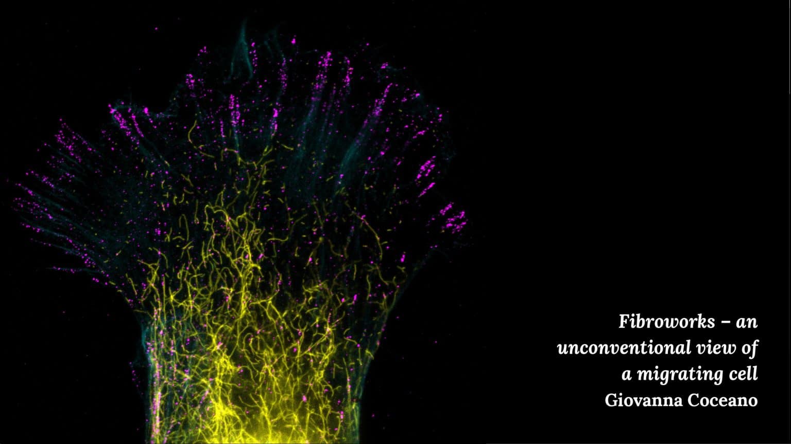 Meet the winners of the Visualizing research at SciLifeLab Campus Solna ...