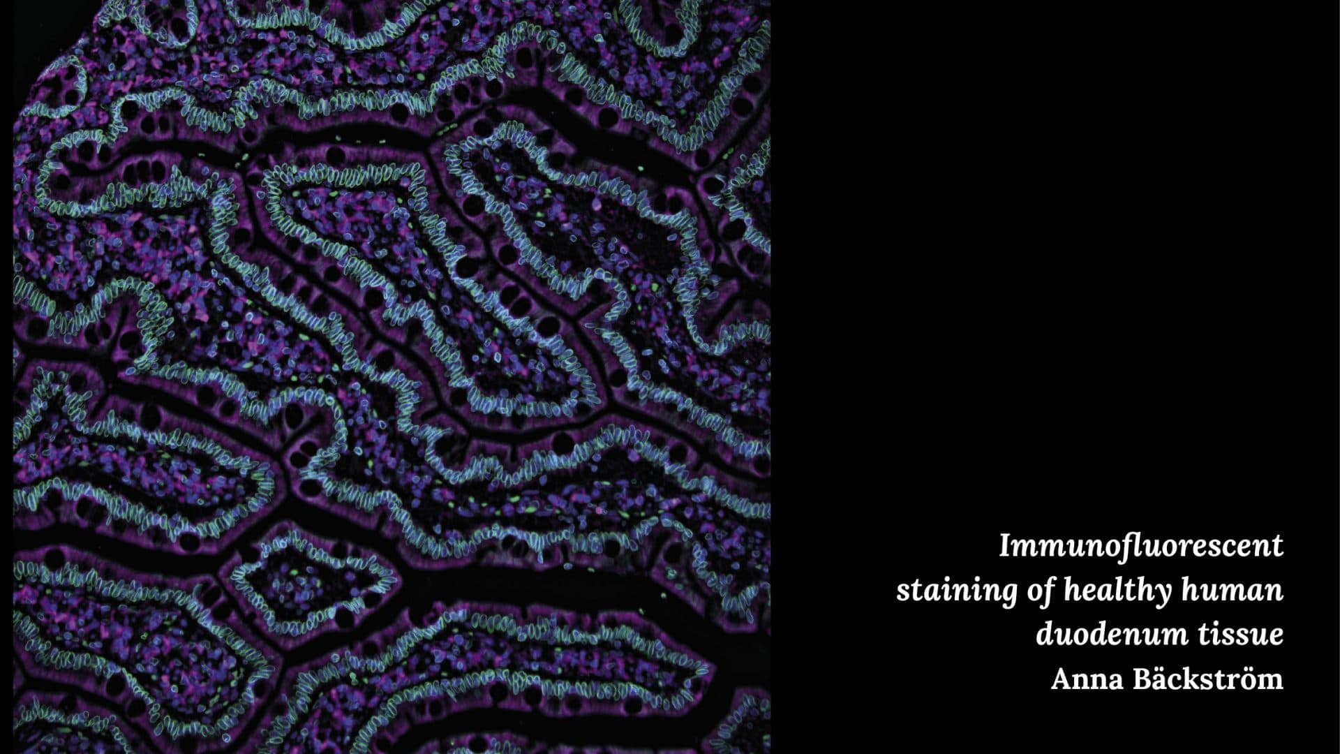 Meet the winners of the Visualizing research at SciLifeLab Campus Solna ...