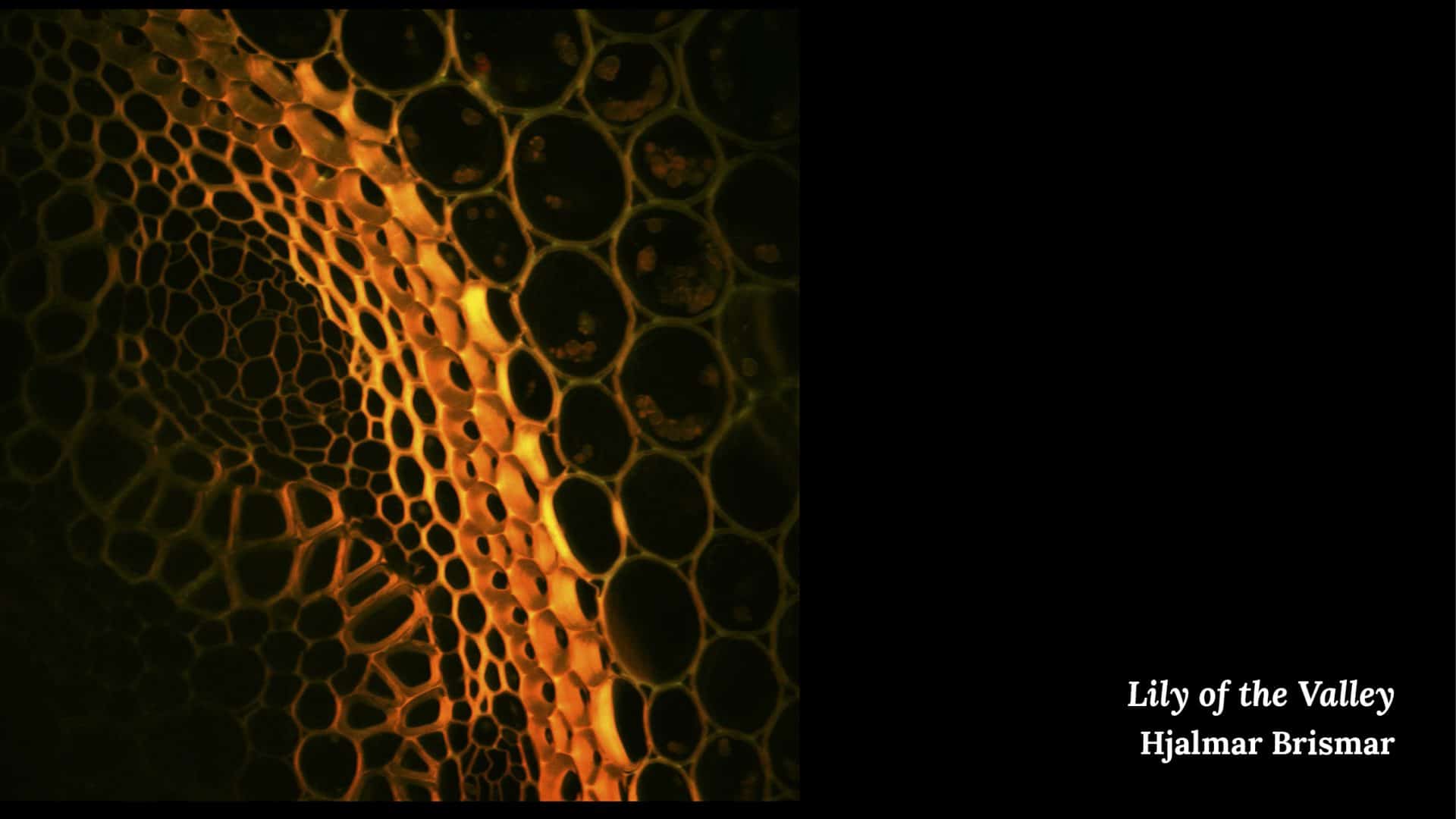 Meet the winners of the Visualizing research at SciLifeLab Campus Solna ...