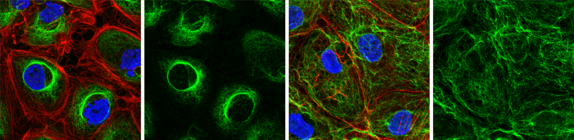 Lynn Butler - SciLifeLab