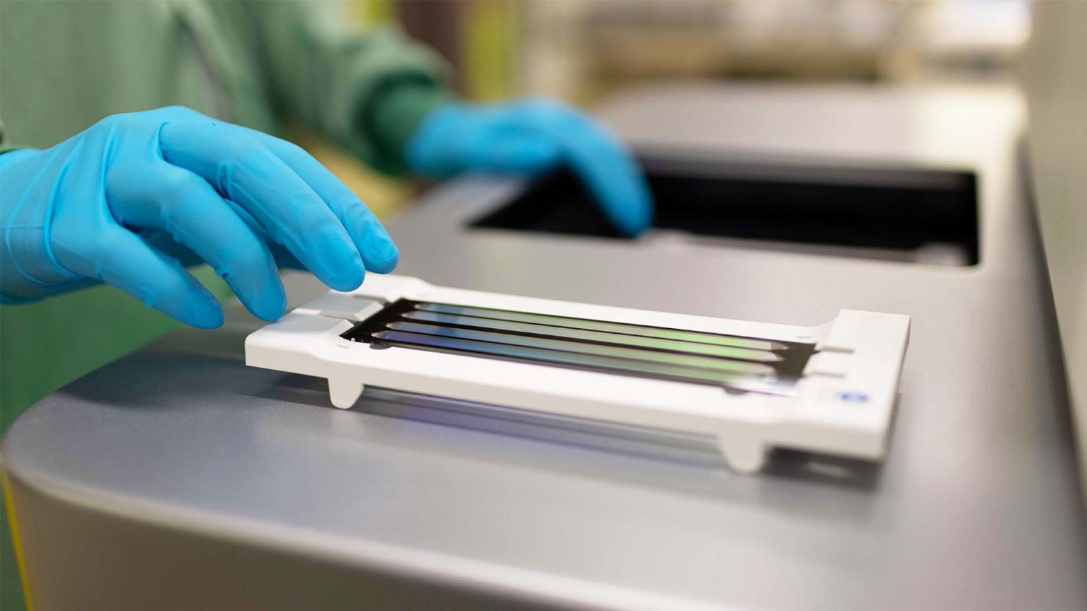 Study explain success story of precision medicine implementation in ...