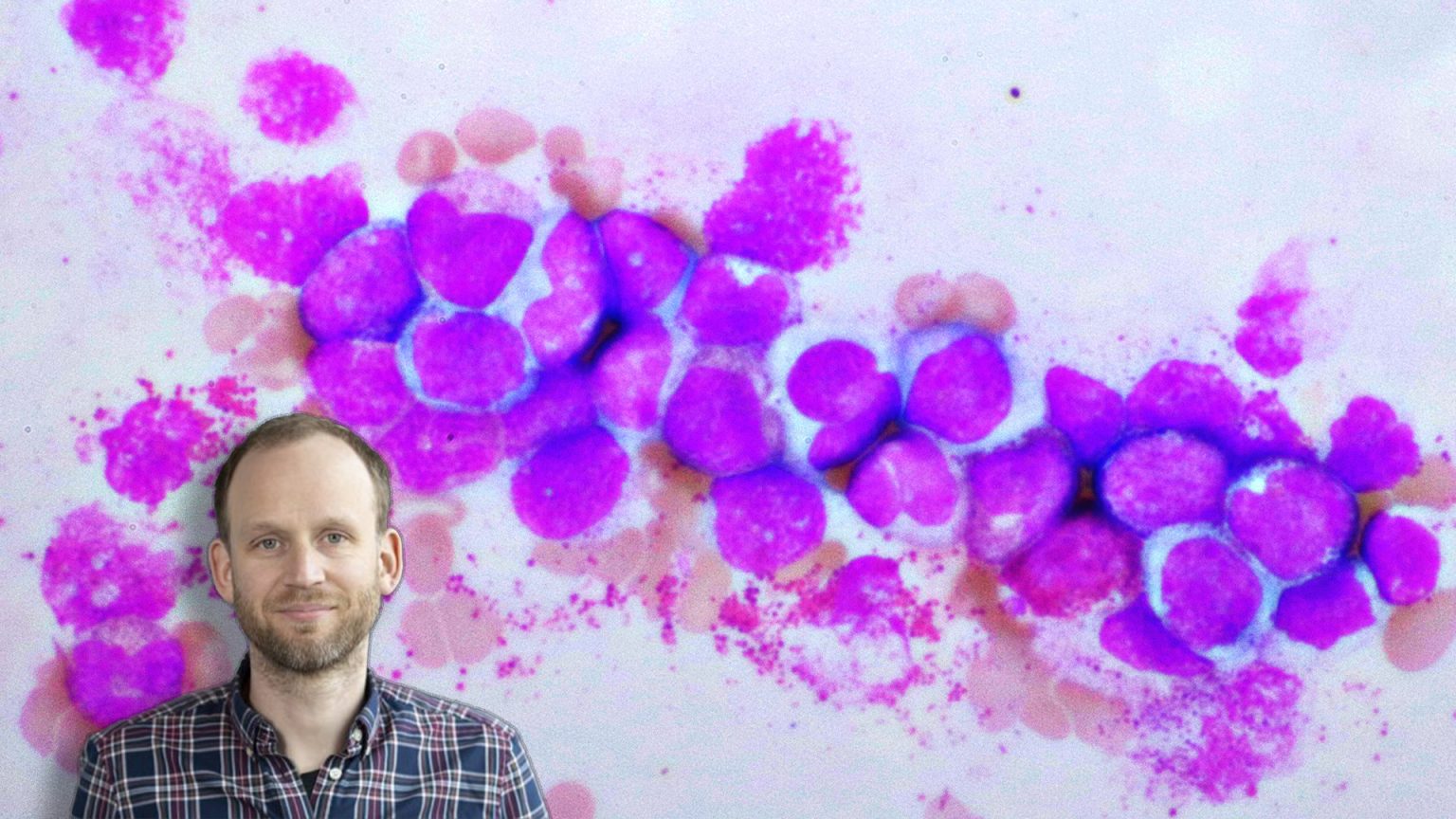 Novel method improves drug resistance screening in myeloid leukemia ...