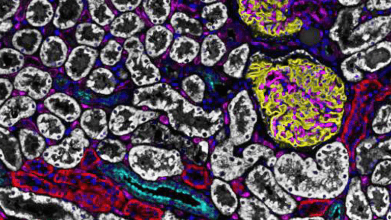 New version of the HPA: New AI-based sections added - SciLifeLab