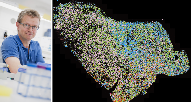 New method paves the way for treatment of incurable brain cancer in ...