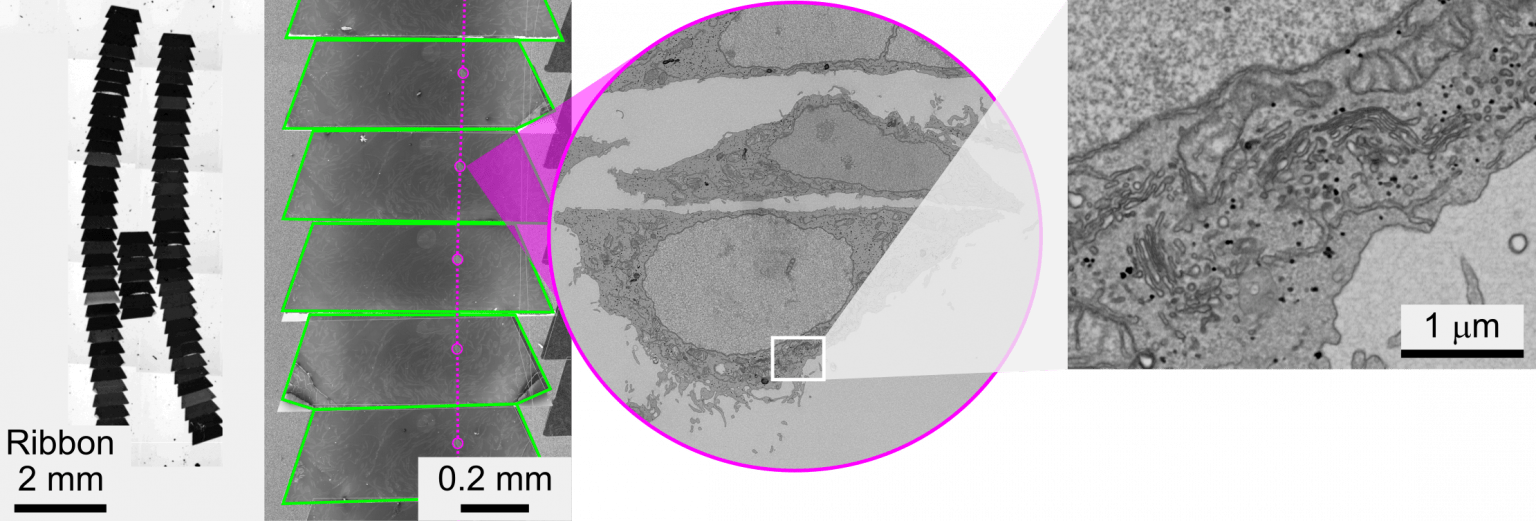 Correlated Array Tomography Workshop - SciLifeLab