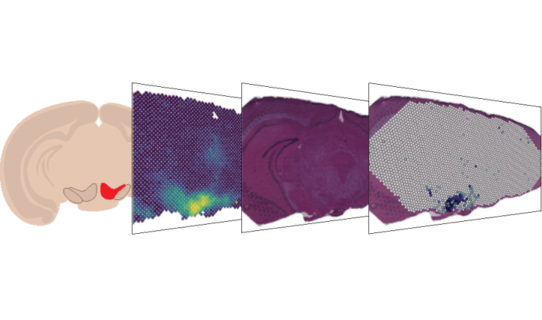 Spatial Multimodal Analysis: Combining Mass Spectrometry and next ...