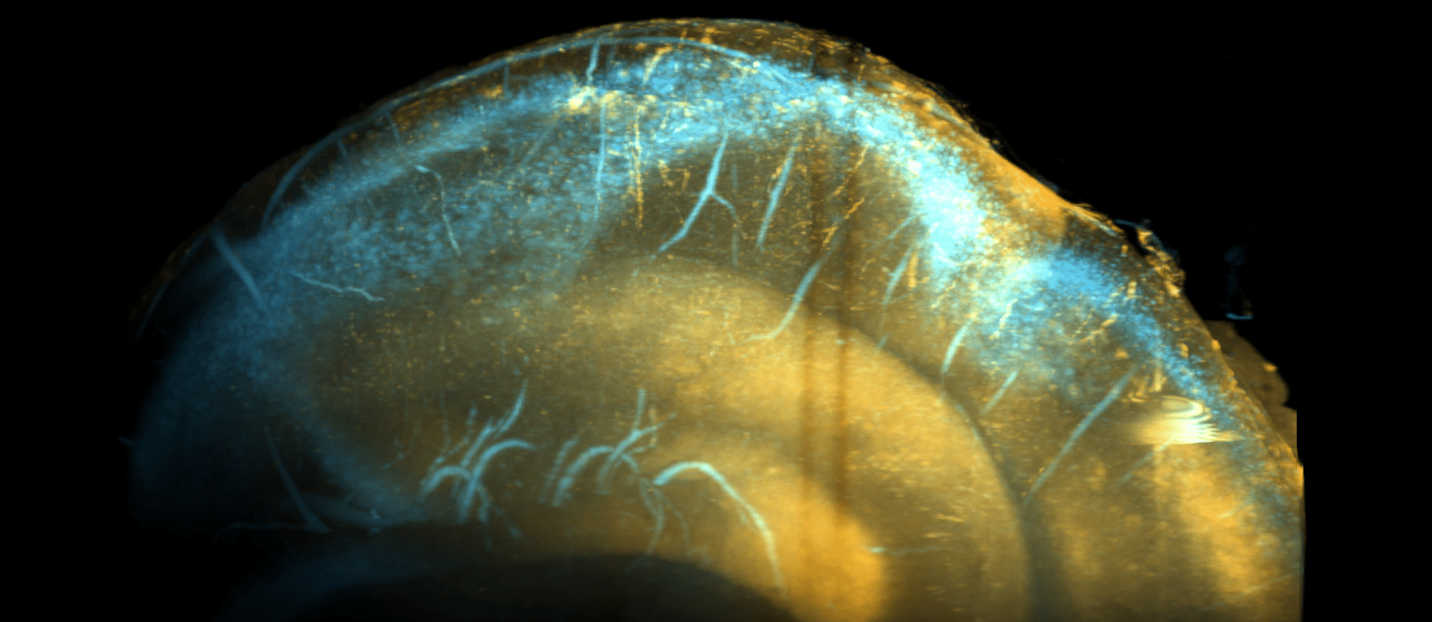 Opening of the Lightsheet 7 at the Centre for Cellular Imaging - SciLifeLab