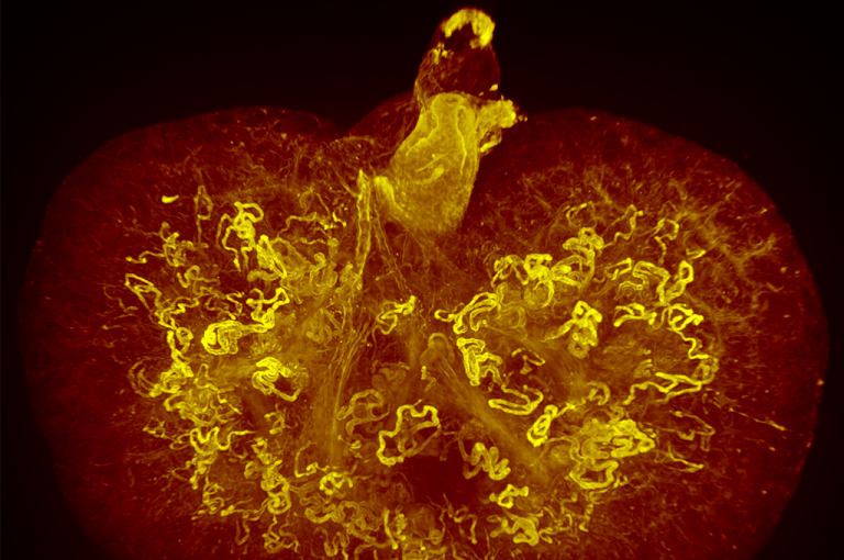 New light-sheet microscope makes tissue clearing techniques more ...