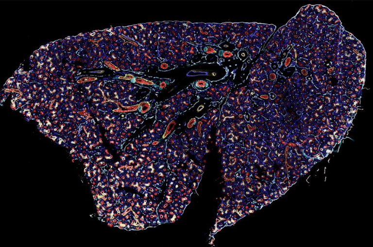 New study reveals protein-level maps of human lung development during ...